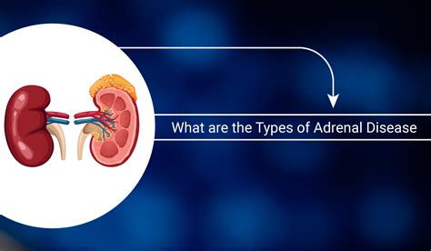 What Are The Types Of Adrenal Disease Dr Moxit Shah