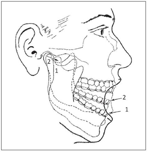 1 Rotation And Translation Of The Mandibular Condyle During Closing 1