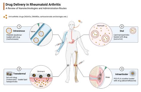 Drug Delivery In Rheumatoid Arthritis Biorender Science Templates