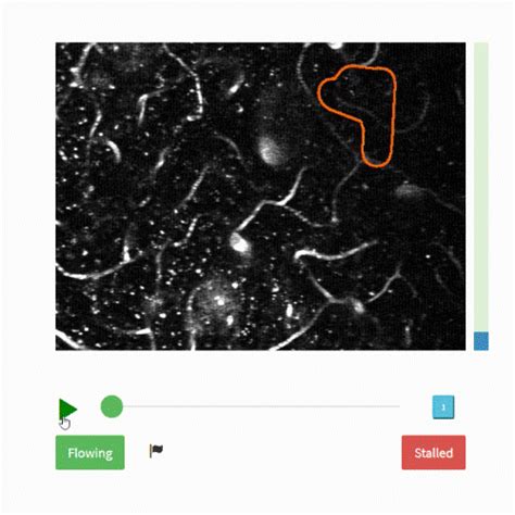 Advance Alzheimers Research With Stall Catchers Matlab Benchmark Code Student Lounge