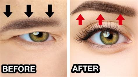 9mins Eyebrow Lift Exercise And Massage Fix Droopy Eyelids Make Your
