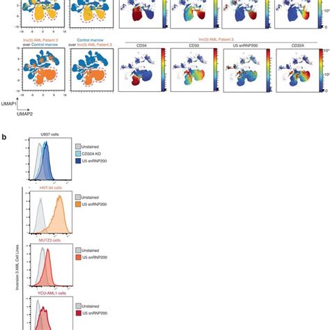 Cell Surface U5 Snrnp200 Expression On Inversion 3 Aml Patient Samples Download Scientific