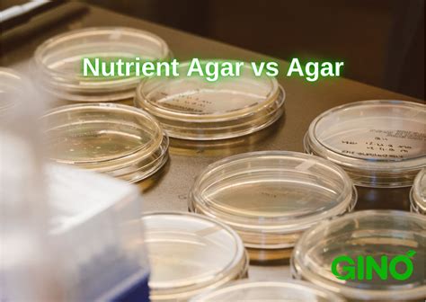 Nutrient Agar Vs Agar Key Differences Uses And Why It Matters