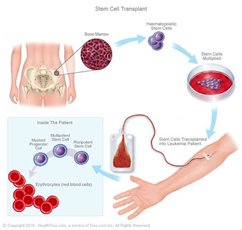 Stemcelltreatment