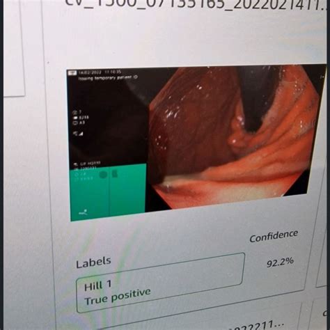 Andreas Edenberg On Linkedin Artificialintelligence Aws