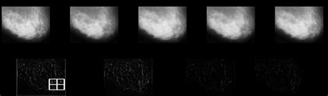 4 Data Pre Processing And Feature Extraction Morphological Operations Download Scientific