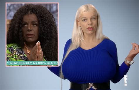 White Model From Botched Identifies As Black Now And Plans To Move To Africa Perez Hilton