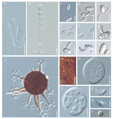 Podosphaera Yulii Facesoffungi Number Fof 06104 Faces Of Fungi