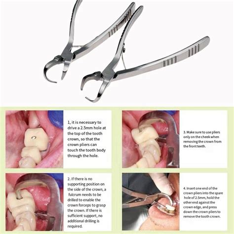 Jual Dental Crown Extractor Forcep Plier Teeth Extraction Plier Forcep