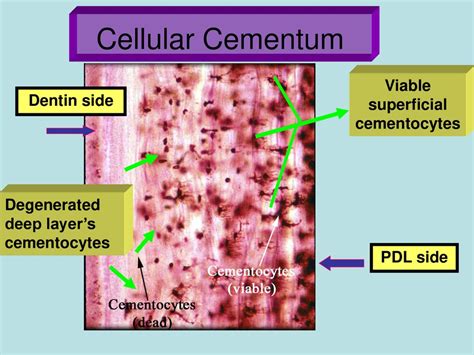 Cementum Ppt Download
