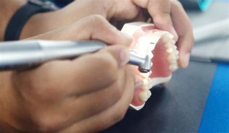 Gc Composite Injection Protocol Medimatch Dental Laboratory