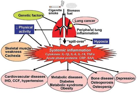 Systemic Inflammation Spill Over Hypothesis In A Patient With Copd Download Scientific