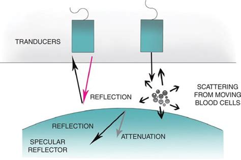 Ultrasound Basics Anesthesia Key
