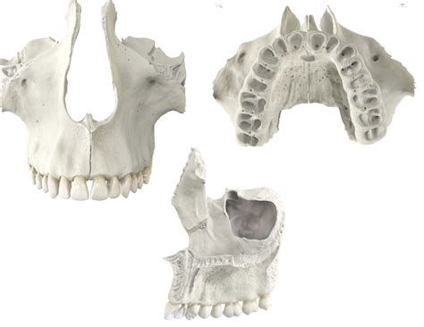 Maxillae Diagram Quizlet