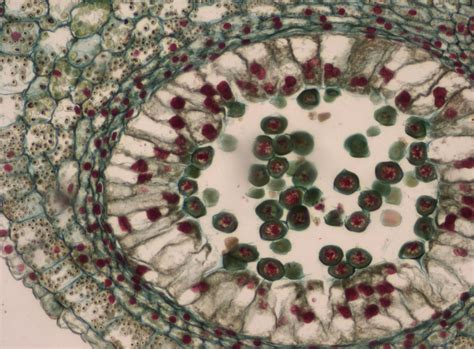 Bio1140 Microscopy Bio1540 Microscopie — Lilium Anther Pollen Tetrads