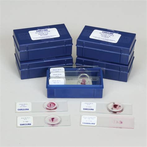 Microscope Slide Set At Jack Radcliffe Blog