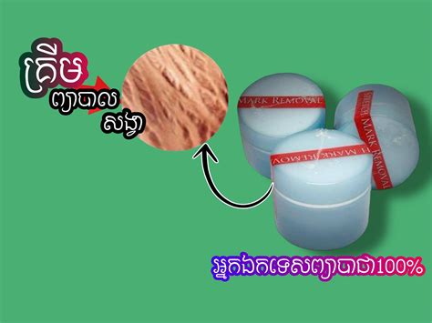 Mscare Mscare Added A New Photo