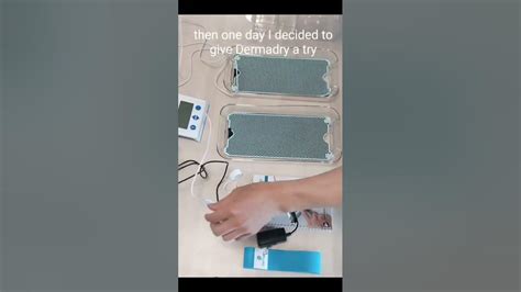 Dermadrys Anti Sweat Device For Hyperhidrosis We Got You 💙💧 Youtube