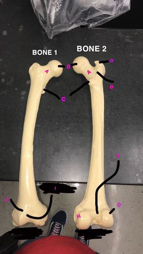 Aandp Appendicular Skeleton Practical Flashcards Quizlet