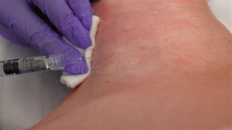 Neck Skin Treatment Stock Footage Video Of Wrinkles 332173318