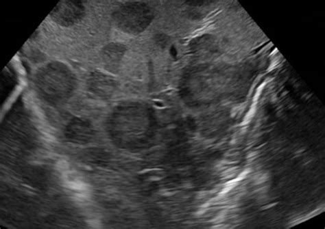 Clinical Approach To Icterus Flashcards Quizlet