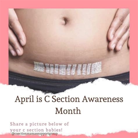 Its Still C Section Awareness Month Ourlittlepreemie