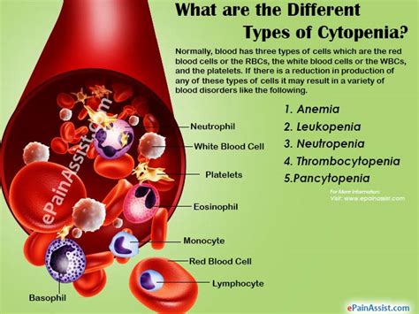 What Is Cytopenia And How Is It Treated