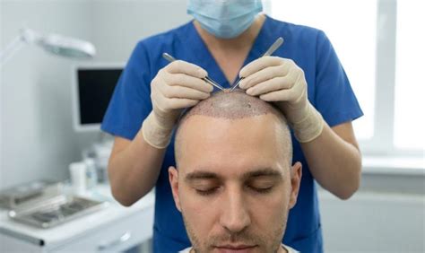 Hair ‍ ‌‍ ‍‌ ‍ ‌‍ ‍‌ Transplant Which Type Of Hair Transplant Is Best