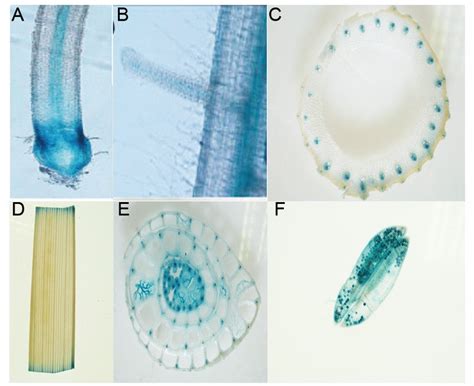 Organic Expression Pattern Of Oscpn60β1 Gus Staining In Axial Root
