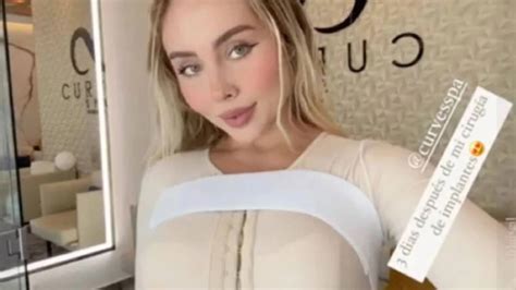 Maya Nazor Presumió Cirugías Y Recibió Críticas Implantes Y Lipo” Infobae