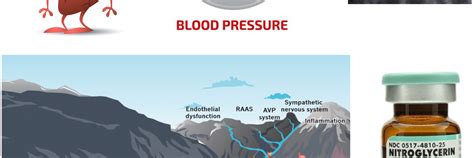 Sympathetic Crashing Acute Pulmonary Edema Scape Insight Into