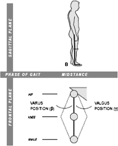 Knee Varusvalgus Motion During Gait A Measure Of Joint Stability In