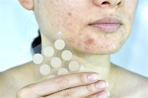 Do Those Pimple Stickers Actually Work Plastic Surgery Practice