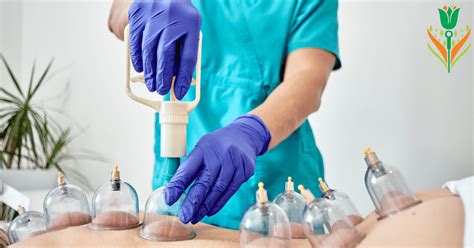 Must Read Cupping Therapy Benefits Home Of Healing Clinic