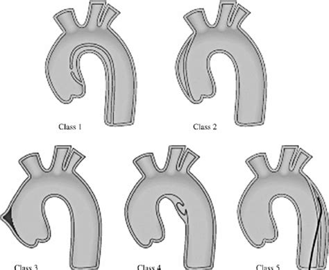 European Society Of Cardiology Classification 4 Download Scientific