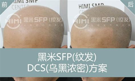 纹发后悔不已？避免终身遗憾的选择指南 知乎
