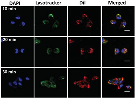 Subcellular Localization Of Gem Nps With Lysosomes In B Cpap Thyroid
