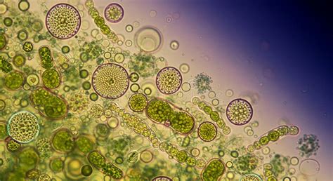 Microscopic View Of Diverse Algae Featuring Circular And Elongated