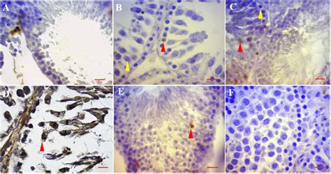 The Effect Of One Cycle Of Bep Regimen With And Without Melatonin On