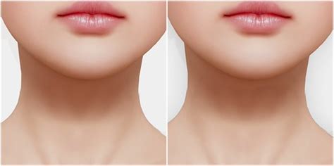 Snow Rabbit Sr Hybrid Avatar Head Nea Juicybomb Second Life Blog