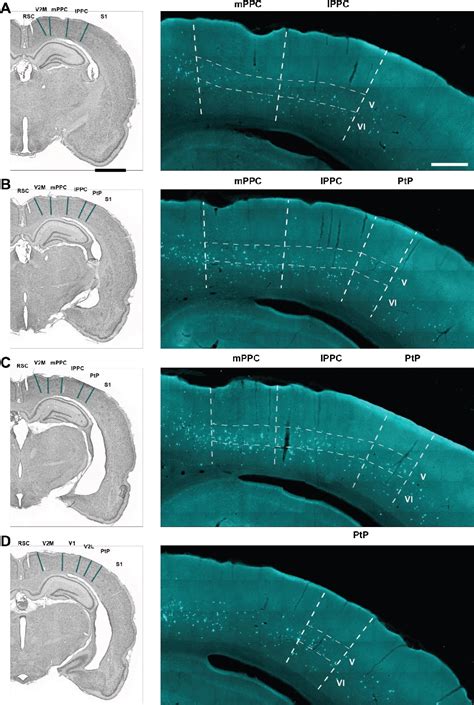 Figure 4 From Projections Of The Posterior Parietal Cortex To The Orbitofrontal Cortex In The