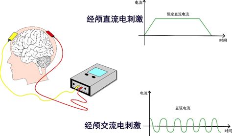 认识大脑 促进脑卒中康复