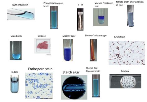 Nitrate Broth After Addition Vogues Proskauer Of Zinc Test Phenol Red