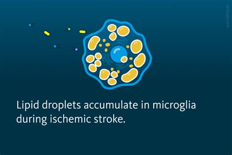 The Role Of Lipid Droplets In Ischemic Stroke Lipotype Gmbh
