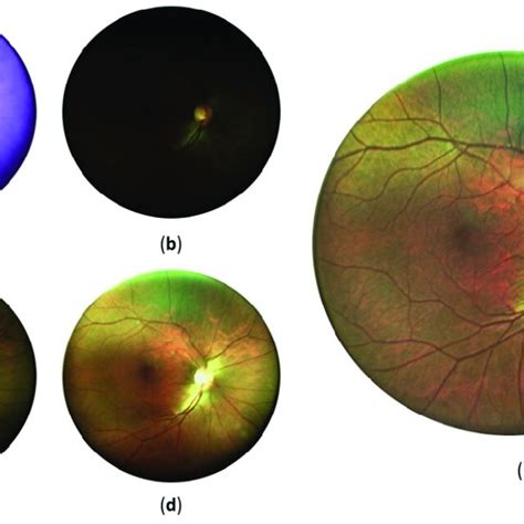 Schematic Illustration Of The Hdr Imaging Principle Download Scientific Diagram