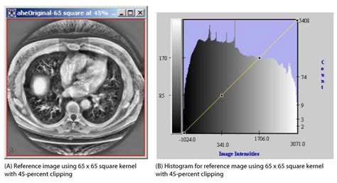 Histogram Equalization Neighborhood Adaptive