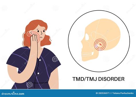 Tmd Tmj Disorder Stock Vector Illustration Of Human 283536571