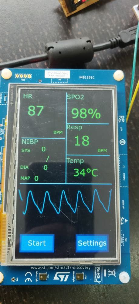 Solved Transmit Multiple Data Using Uart And Free Rtos Stmicroelectronics Community