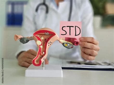 Understanding Stds Symptoms Causes And Treatments