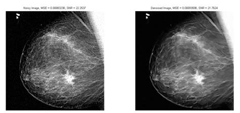 modified multi wavelet noise filtering algorithm for mammographic image